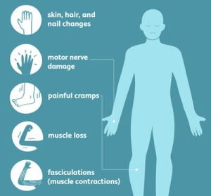 Peripheral Neuralgia Treatment NYC | Hand, Feet Specialists