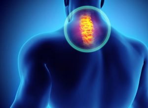 Upper Back Pain Treatment NYC | Board-Certified Specialists & Doctors