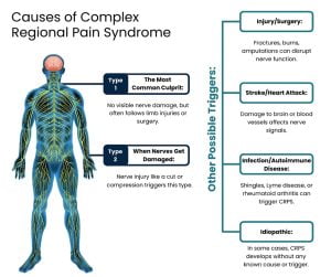 Complex Regional Pain Syndrome (CRPS) Treatment NYC