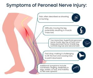 Peroneal Nerve Treatment in NYC | Pain Management NYC