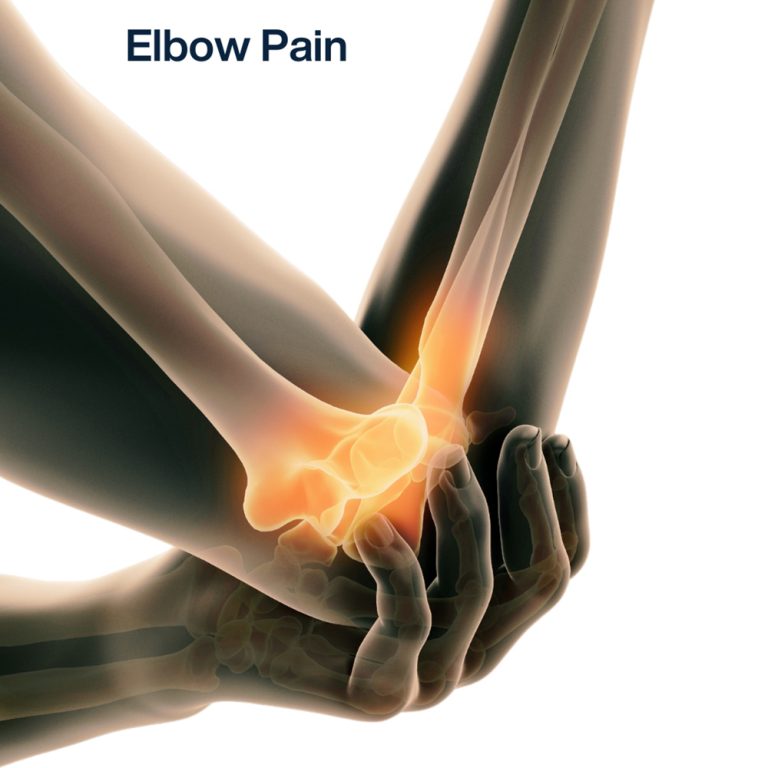 How to Treat Elbow Pain from Weightlifting | Pain Management NYC